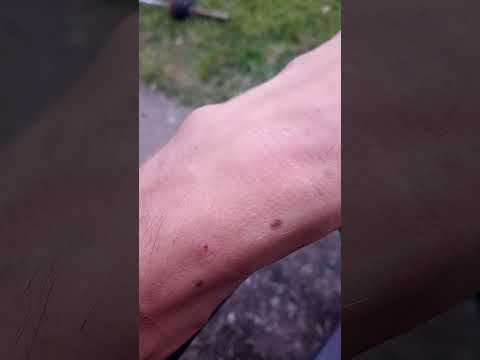 DIVINE HEALING WITH SETIAN MAGIC. NO MORE BIBLE CYST. INSTANT PAINLESS ...