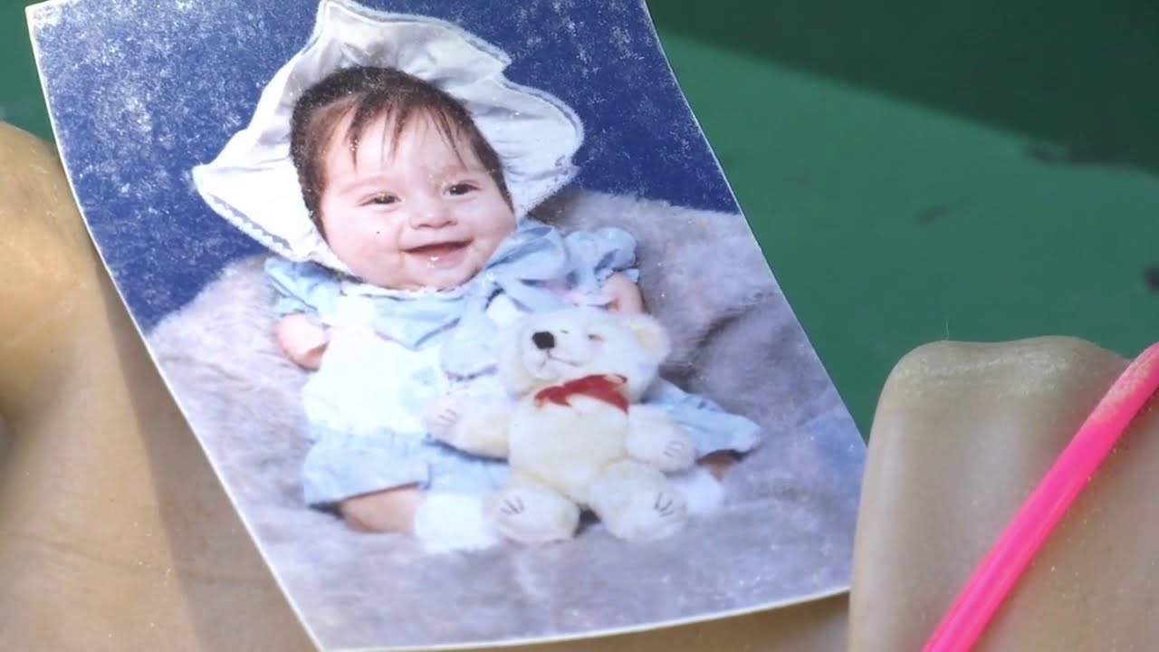 Raising awareness on phocomelia - YouTube