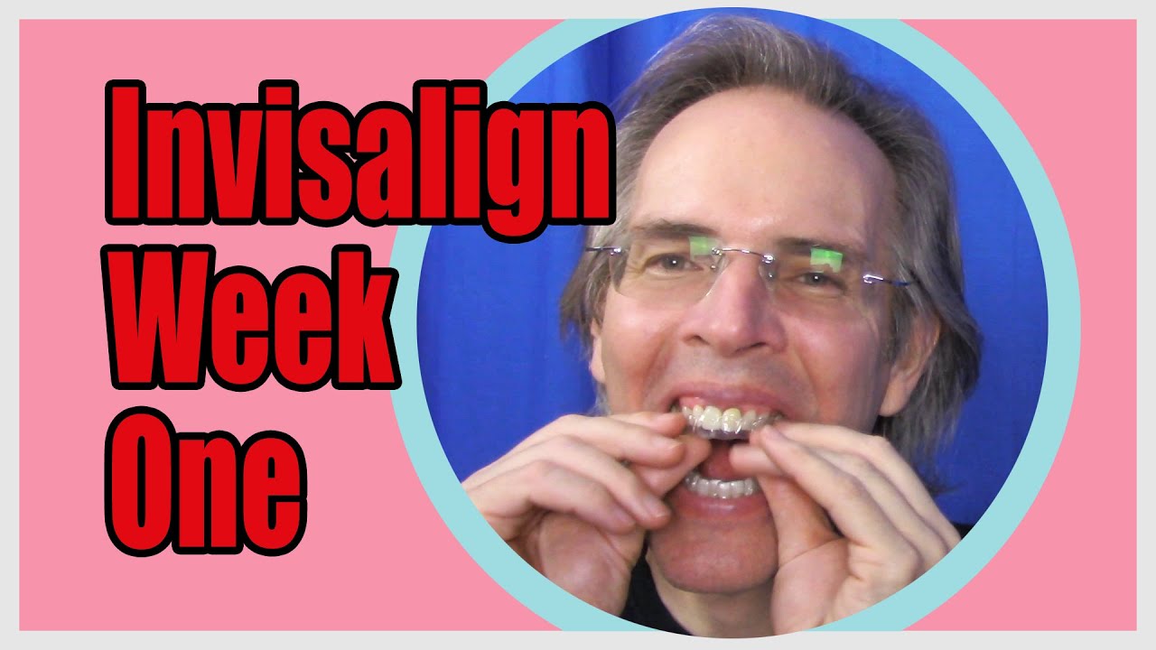 Invisalign: Week One - YouTube