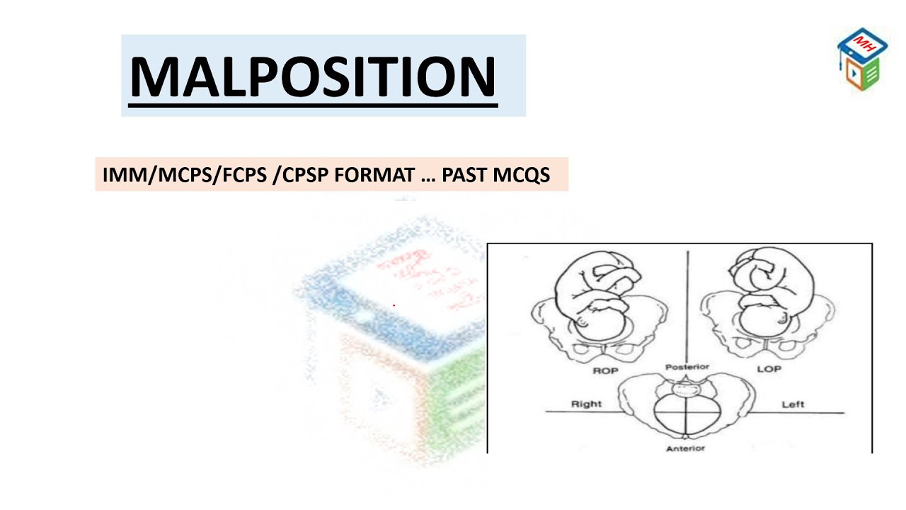 MALPOSITION - YouTube