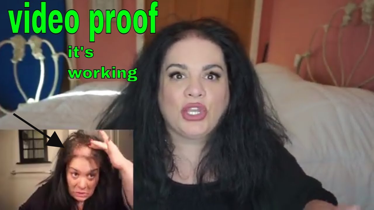 Hair Growth Update WEEK 6 VIDEO PROOF IT'S WORKING - YouTube