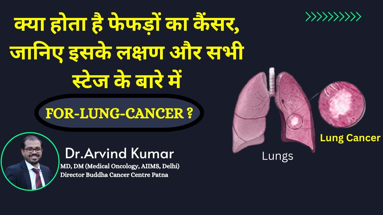 क्या होता है फेफड़ों का कैंसर, जानिए इसके लक्षण और सभी स्टेज के बारे ...