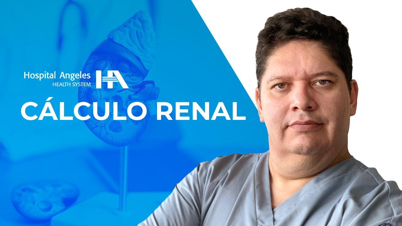 Cálculos renales: Todo lo que necesitas saber en un solo video - YouTube