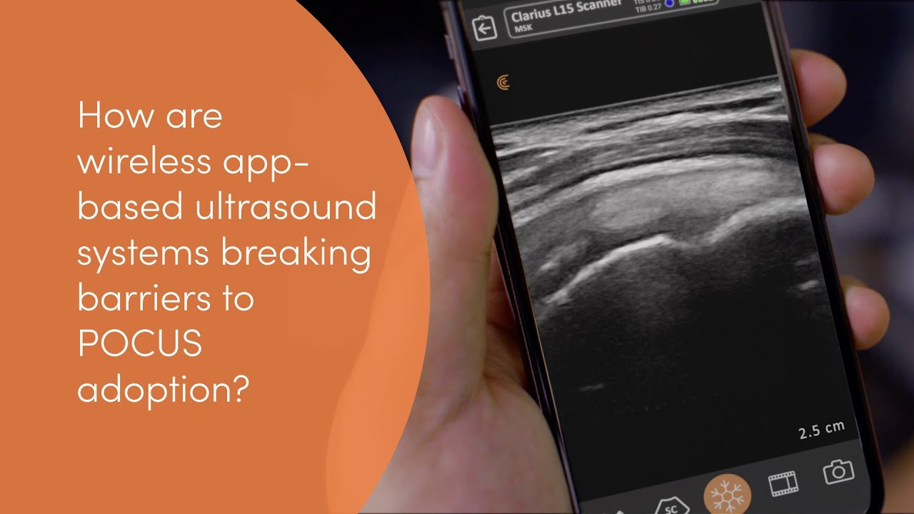Handheld POCUS: Dropping Barriers to Better Patient Care - YouTube