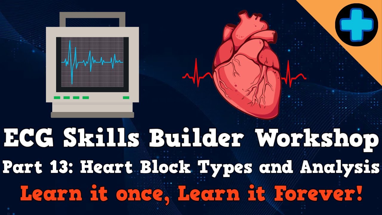 Electrocardiogram (ECG) Skills Builder Workshop Part 13: Heart Block ...