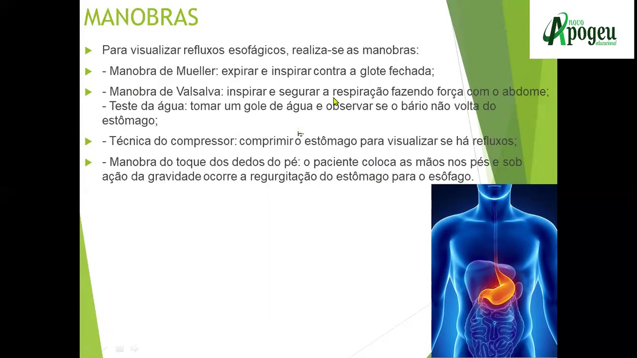 Aula 04 Exames contrastados esofagografia Prof Jefferson Oliveira - YouTube