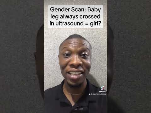 Baby leg always crossed during gender ultrasound = girl? #shorts #fyp # ...