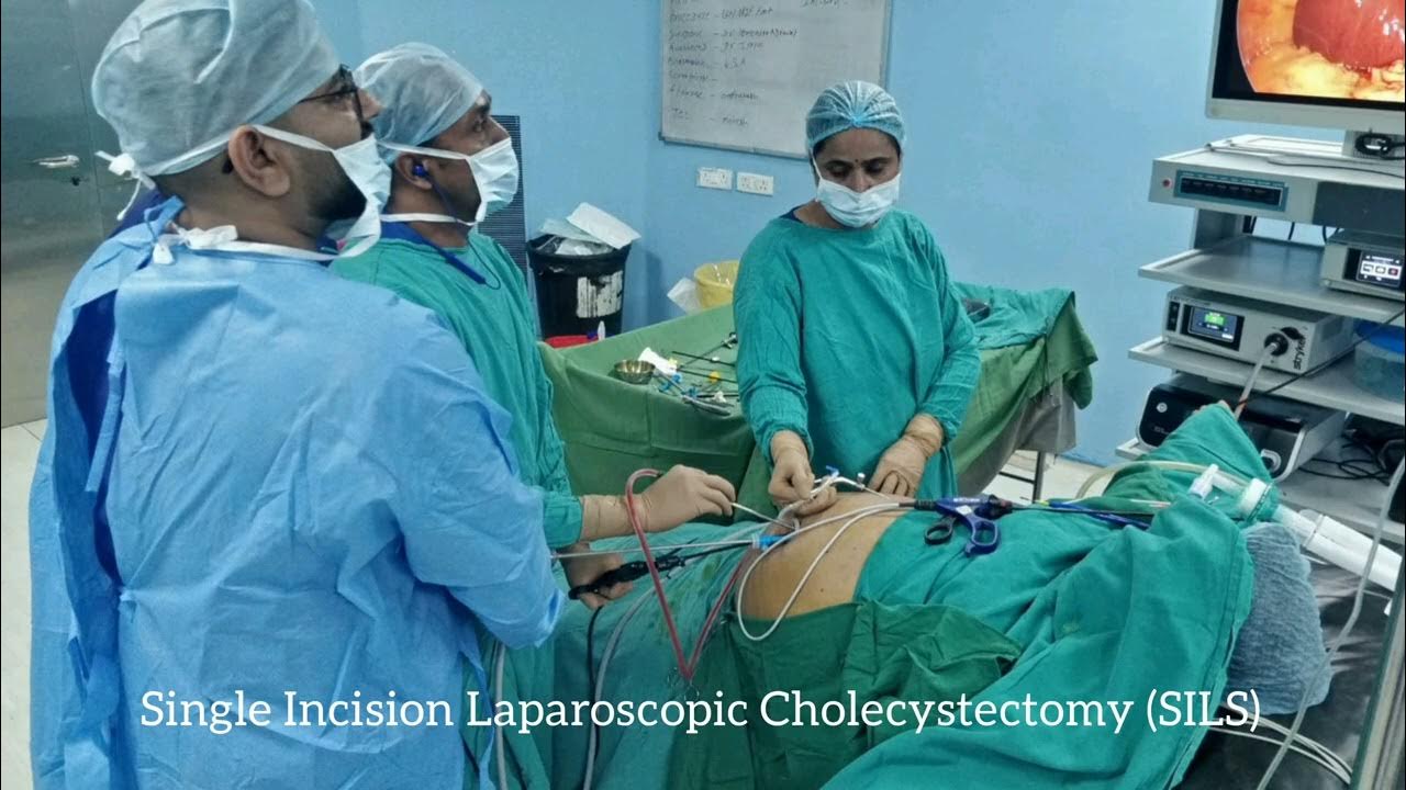 Single Incision Laparoscopic Cholecystectomy (SILS) - YouTube