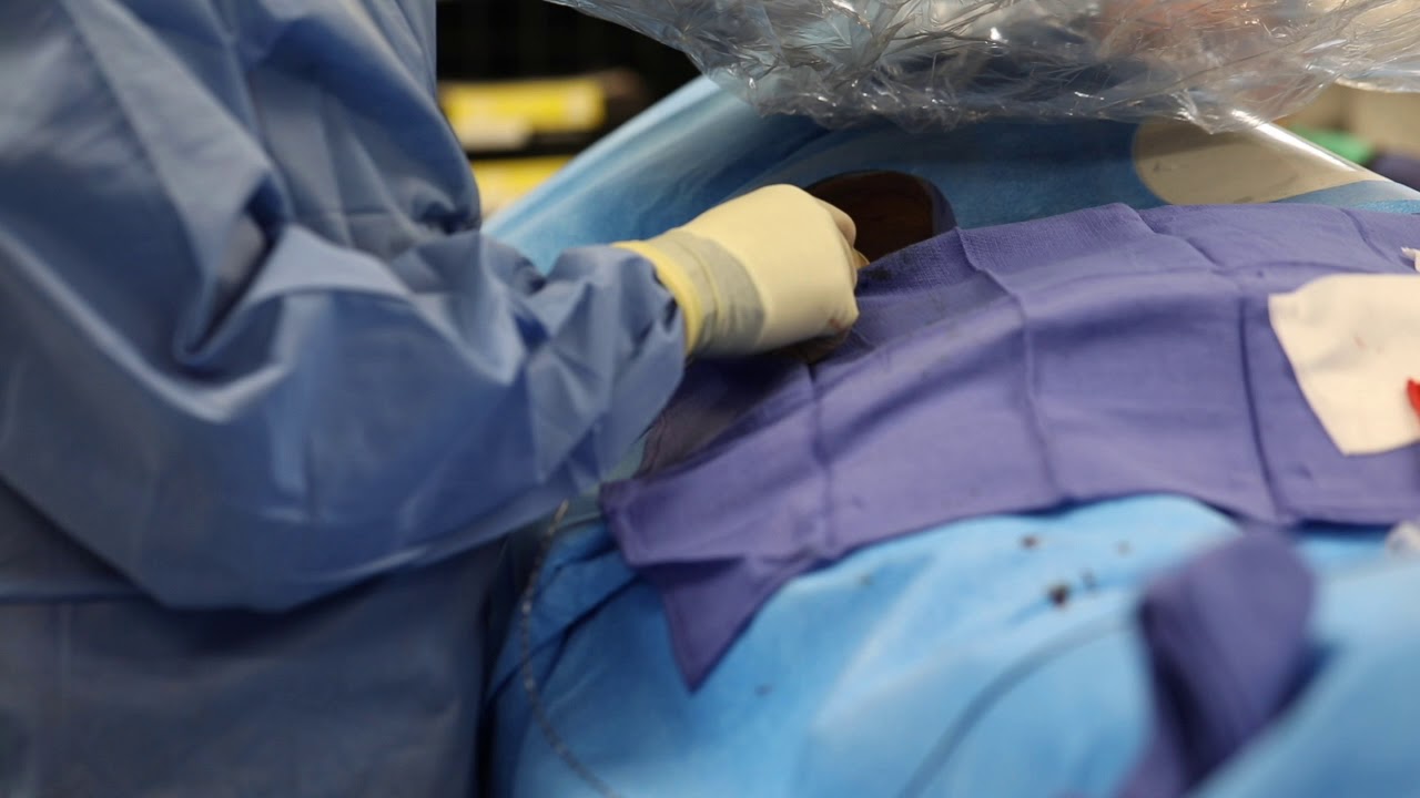 Dr.Jayanetti from Miami Vascular Surgery - YouTube