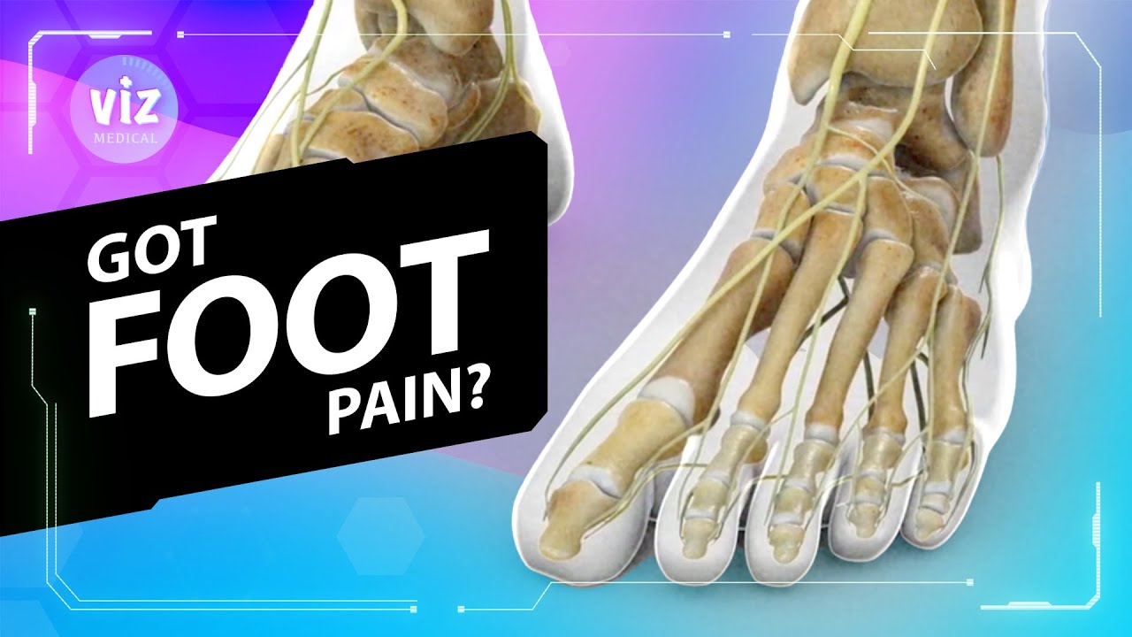 The cause of your foot pain (3D Animation) - YouTube
