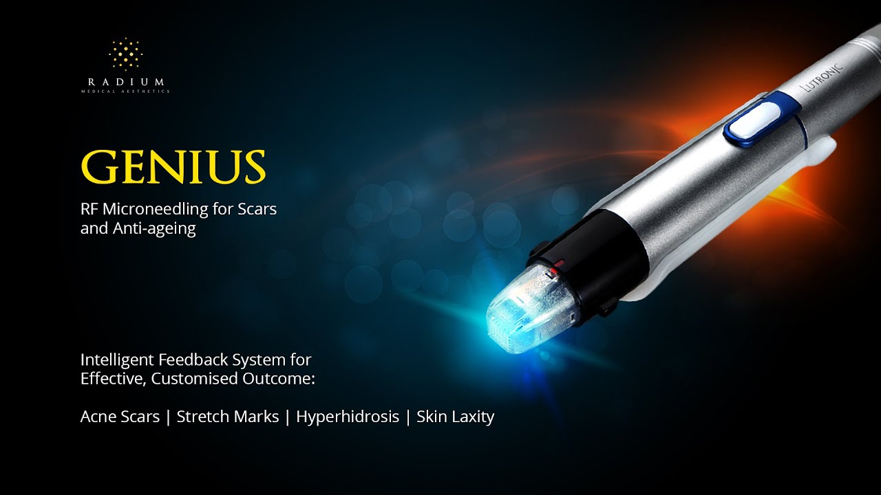 Genius RF Micro-needling Treatment for Scars and Anti-Ageing - YouTube