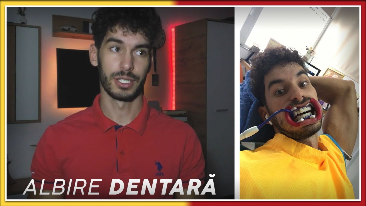 MI-AM ALBIT DINȚII - Cum a fost? - Tot ce trebuie să știi despre albire ...