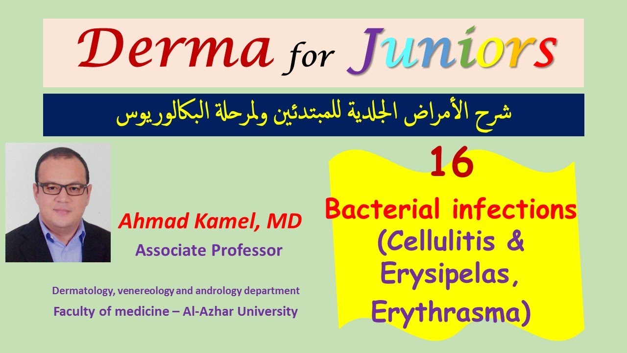 016 Cellulitis Erysipelas Erythrasma Bacterial Skin Infections - YouTube