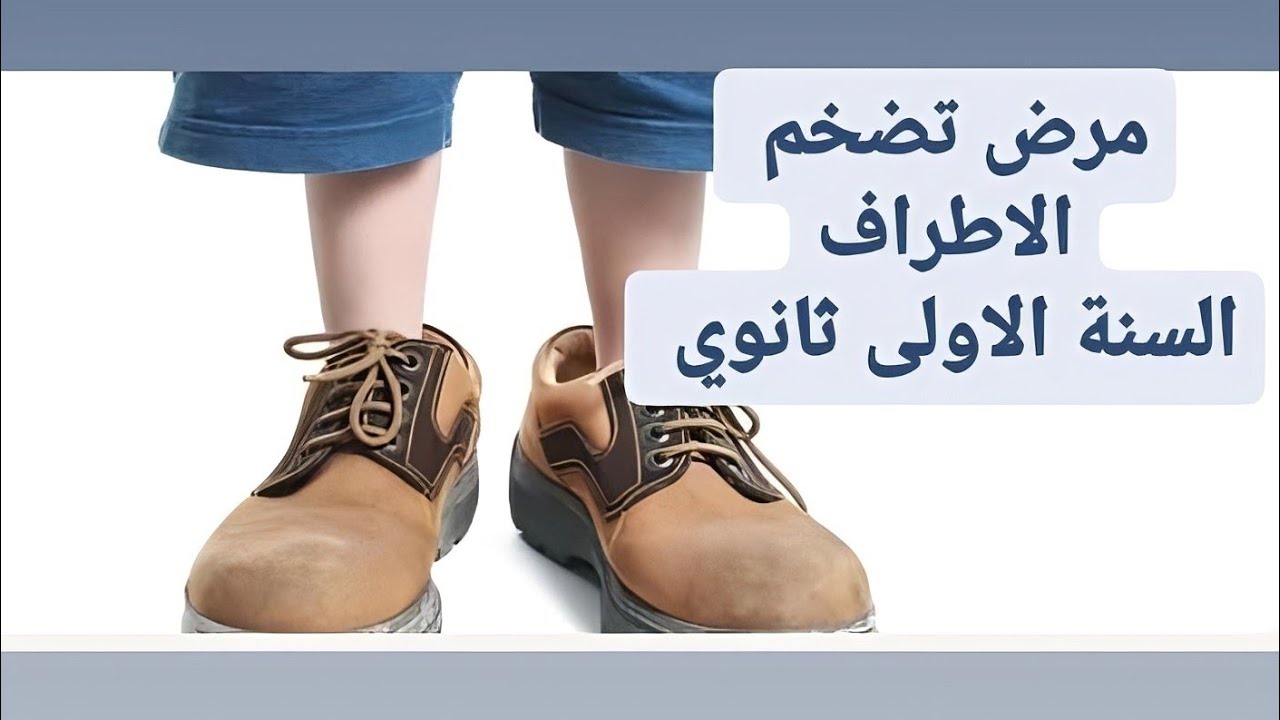 حل تمرين حول مرض تضخم الاطراف سنة اولى ثانوي وحدة آليات النمو و التجديد Youtube