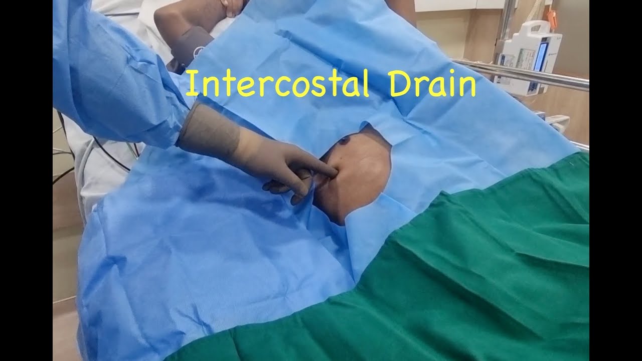 Chest Drain Intercostal Drain Icu Bed Side Procedure Haemothorax Drainage Youtube