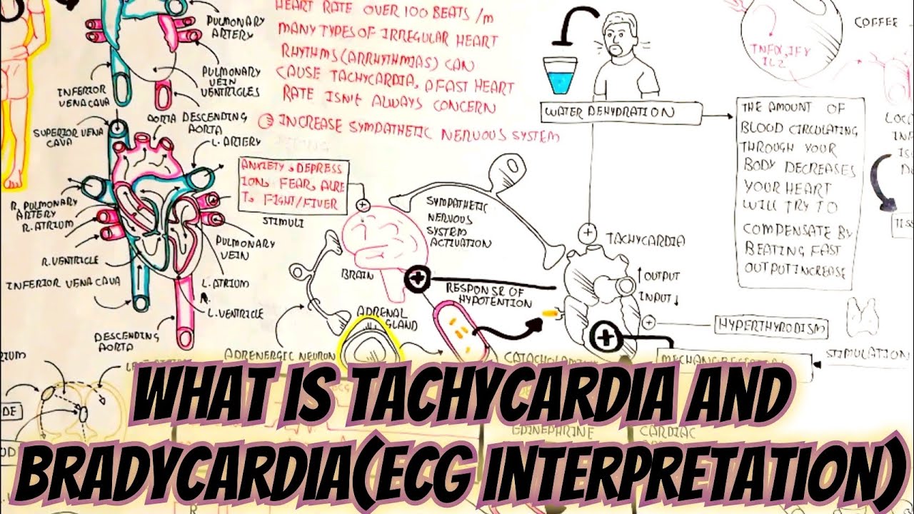 Tachycardia||Bradycardia,ECG Interpretation,Cardiology ...