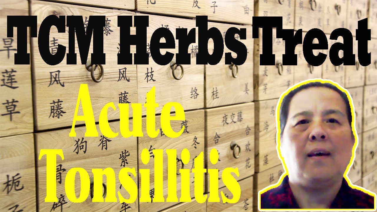 TCM Herbs Treat Acute Tonsillitis - YouTube