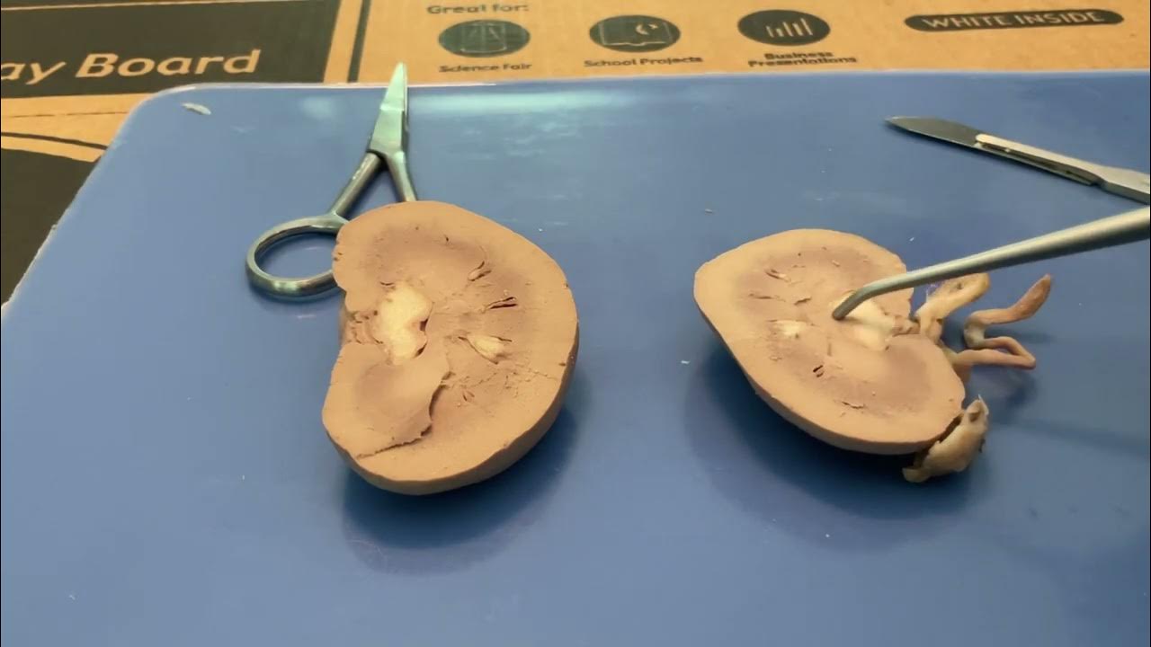 Sheep kidney Dissection - YouTube
