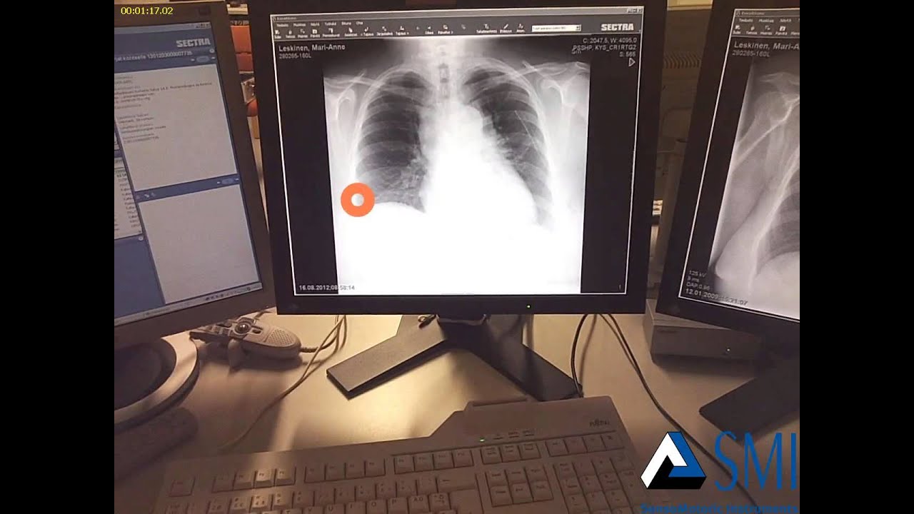 X-ray - eye tracking - YouTube