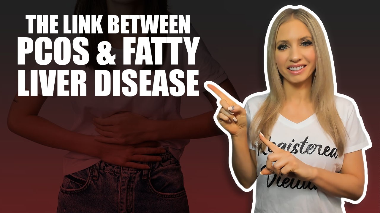 Nonalcoholic Fatty Liver Disease: A Hidden Risk of PCOS - YouTube