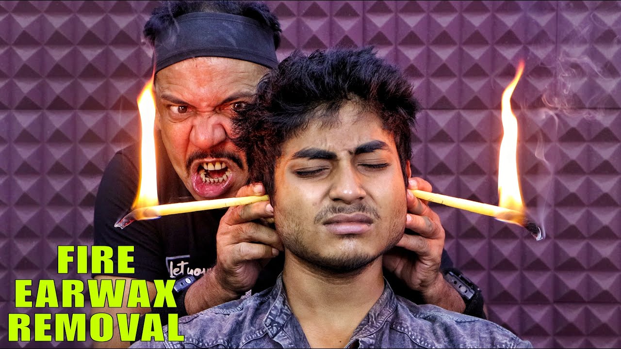 Fire Earwax Removal By Asim Barber Ear Cleaning By Ear Candles Head