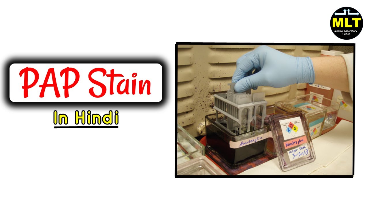 Pap stain procedure in cytology || Pap stain principle and procedure in ...