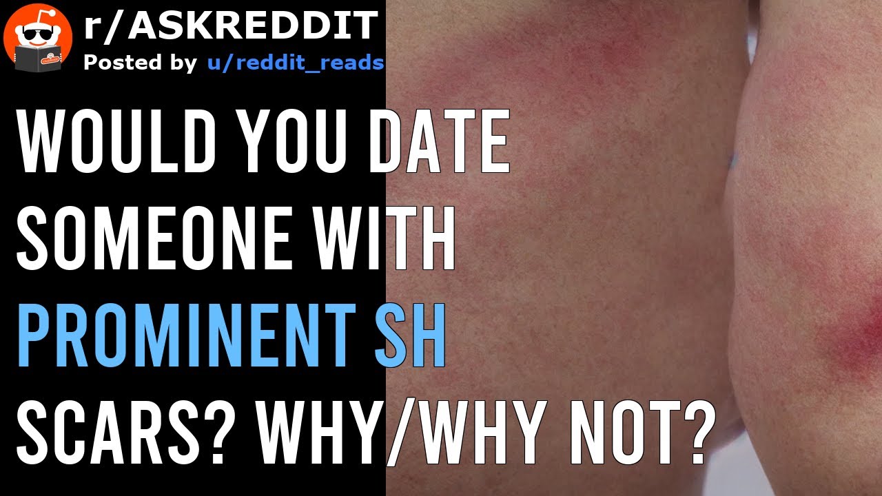 Would you date someone with prominent SH scars? Why/why not? - YouTube