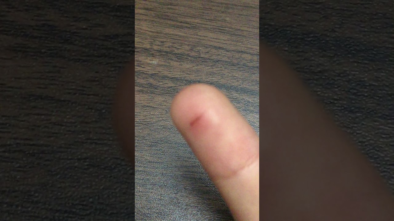 Real Paper Cut Finger YouTube real-paper-cut-finger-youtube
