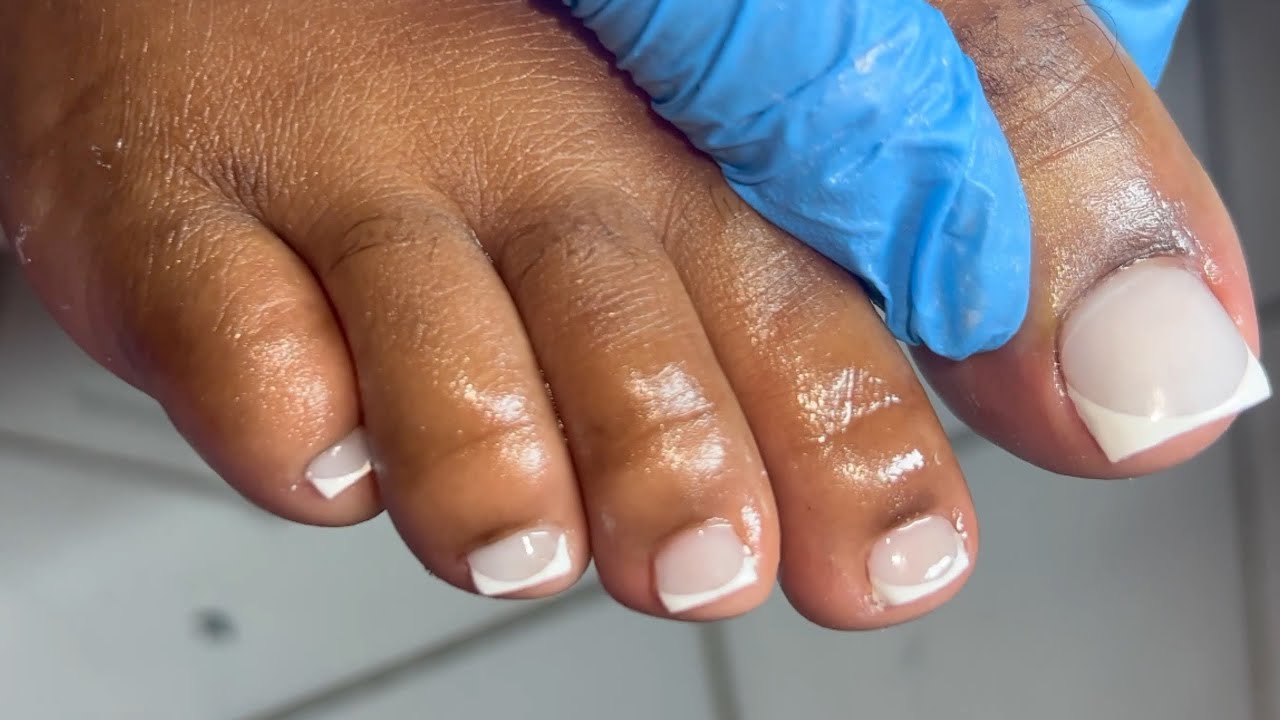 FRENCH ACRYLIC TOES | ACRYLIC TOES WITH NO TIPS | ACRYLIC OVERLAY ON ...