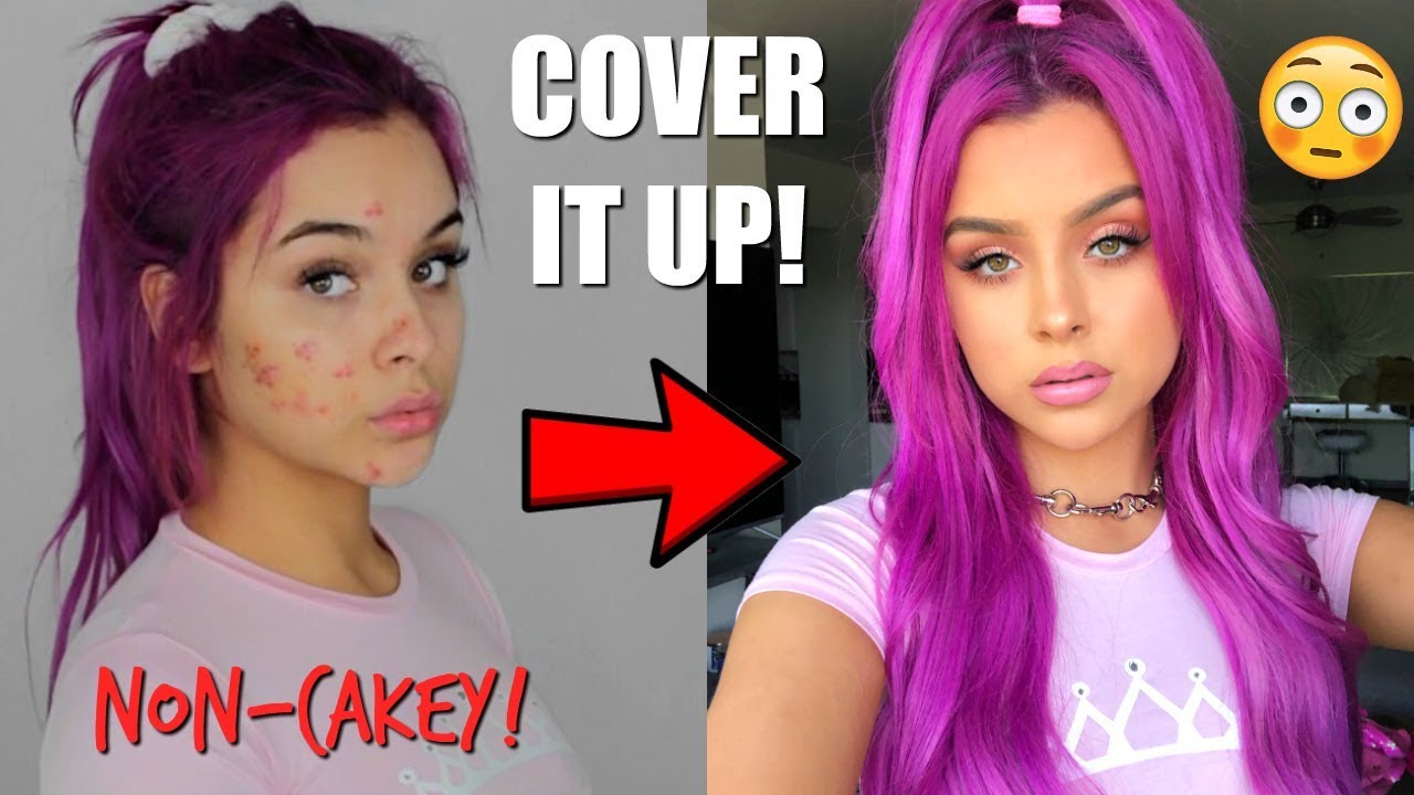 How I Cover My Acne Scars + Bumps (NON CAKEY!) - YouTube