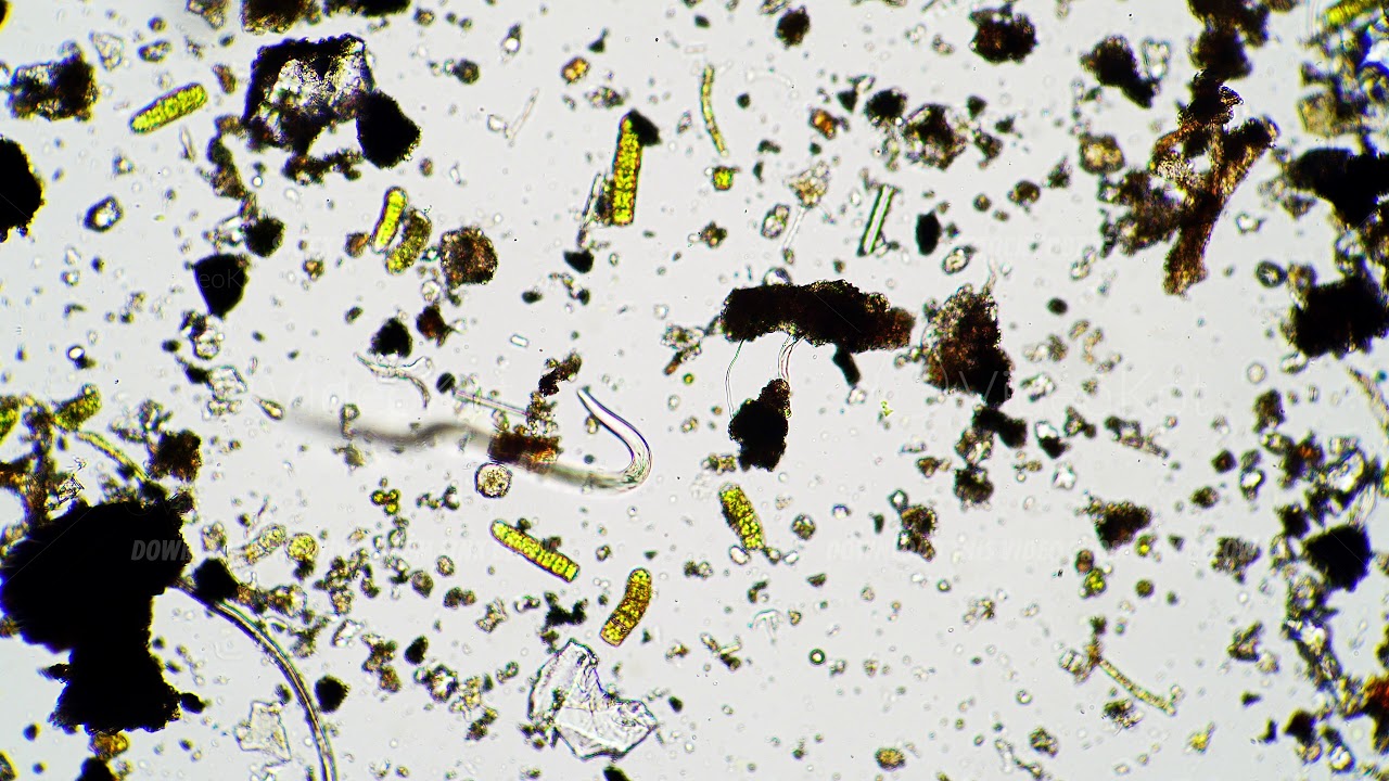 Transparent worm is wiggling amongst other microorganisms and pieces of ...