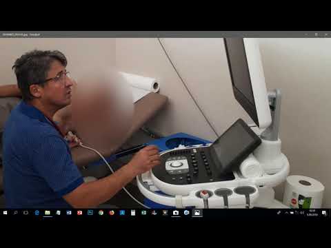 Ekokardiyografi nedir? EKG nedir? Dr. Yakup Balaban