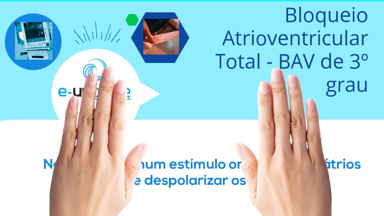 Eletrocardiograma - BAVT (bloqueio atrioventricular total) - YouTube