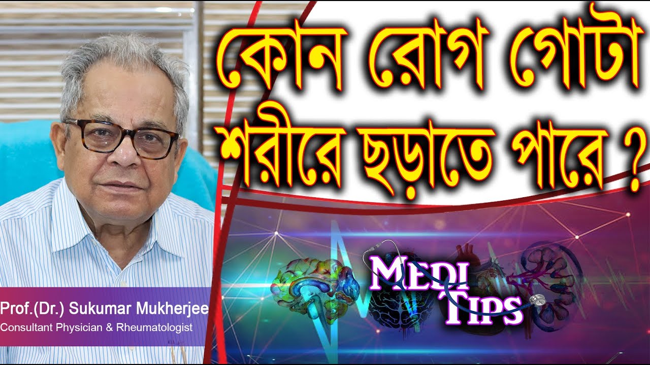 Systemic Lupus Erythematosus (SLE): Signs & Treatment || Prof.(Dr ...