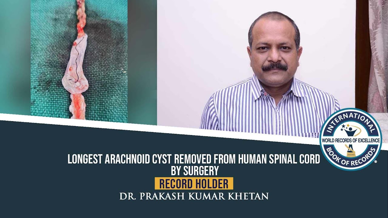 LONGEST ARACHNOID CYST REMOVED FROM HUMAN SPINAL CORD BY SURGERY - YouTube