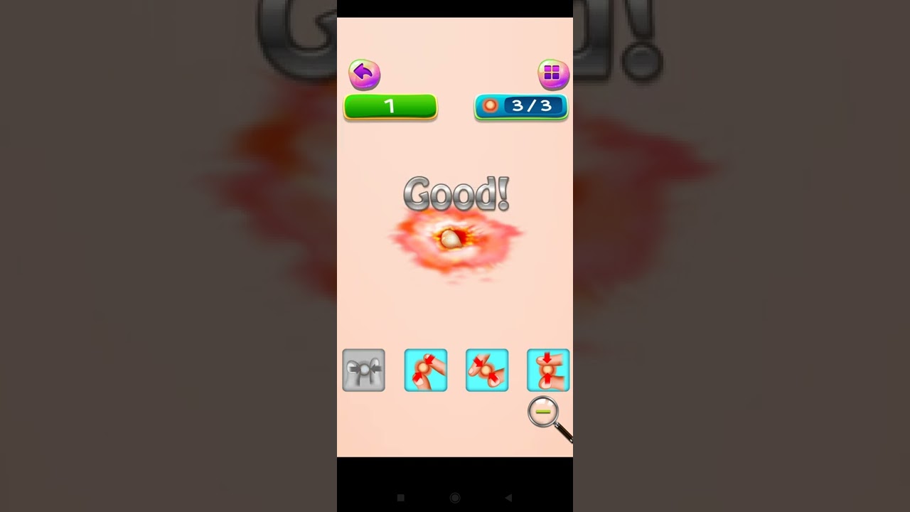 ASMR Huge Acne Pimples Popping up #5 - YouTube