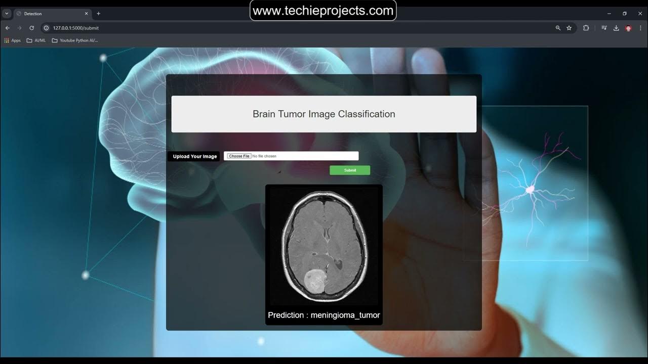 Brain Tumor Detection using Machine Learning Project | Image Processing Projects using Python ...