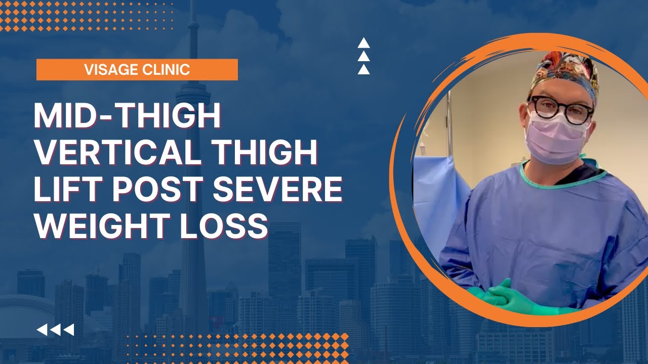 Mid-Thigh Lift | Visage Clinic Toronto - YouTube