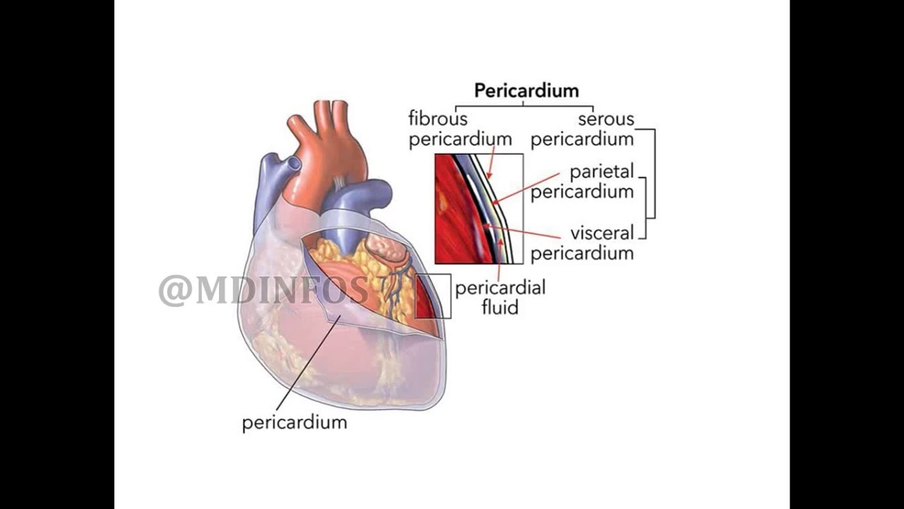 Pericardial effusion - Types of fluid - YouTube