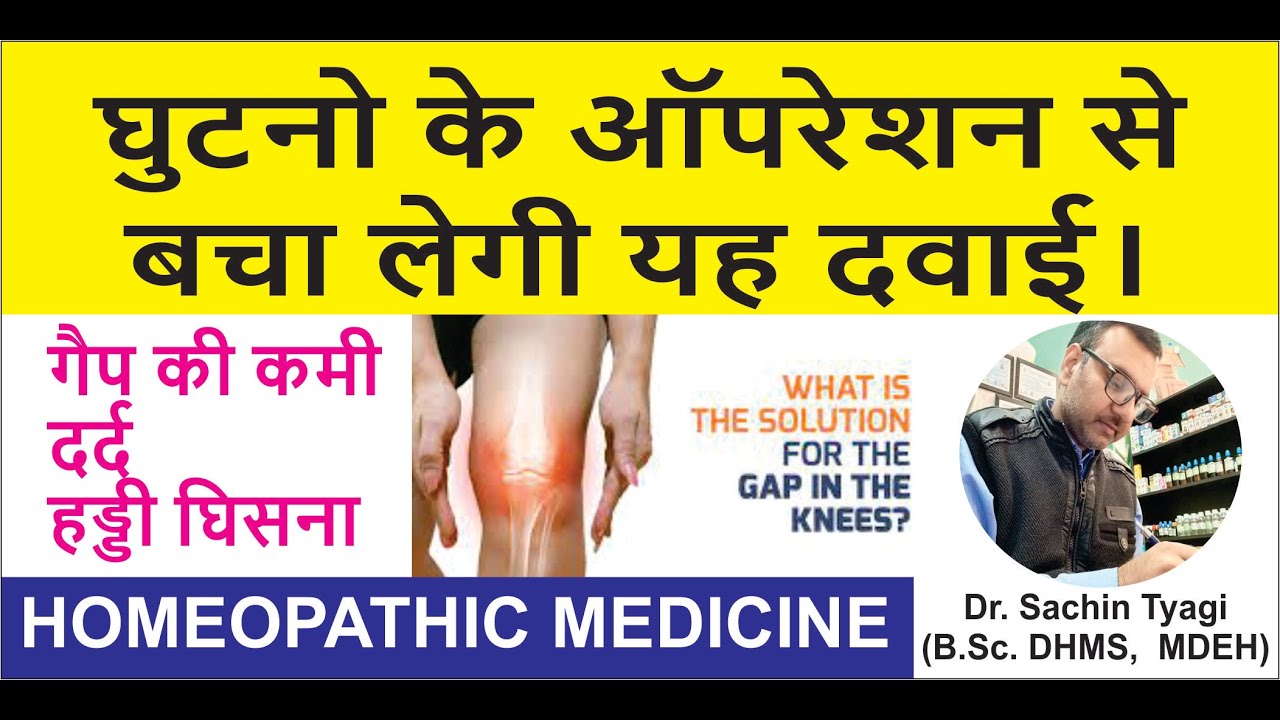घुटनो के दर्द का Permanent Treatment | घुटनो में दर्द का इलाज ...