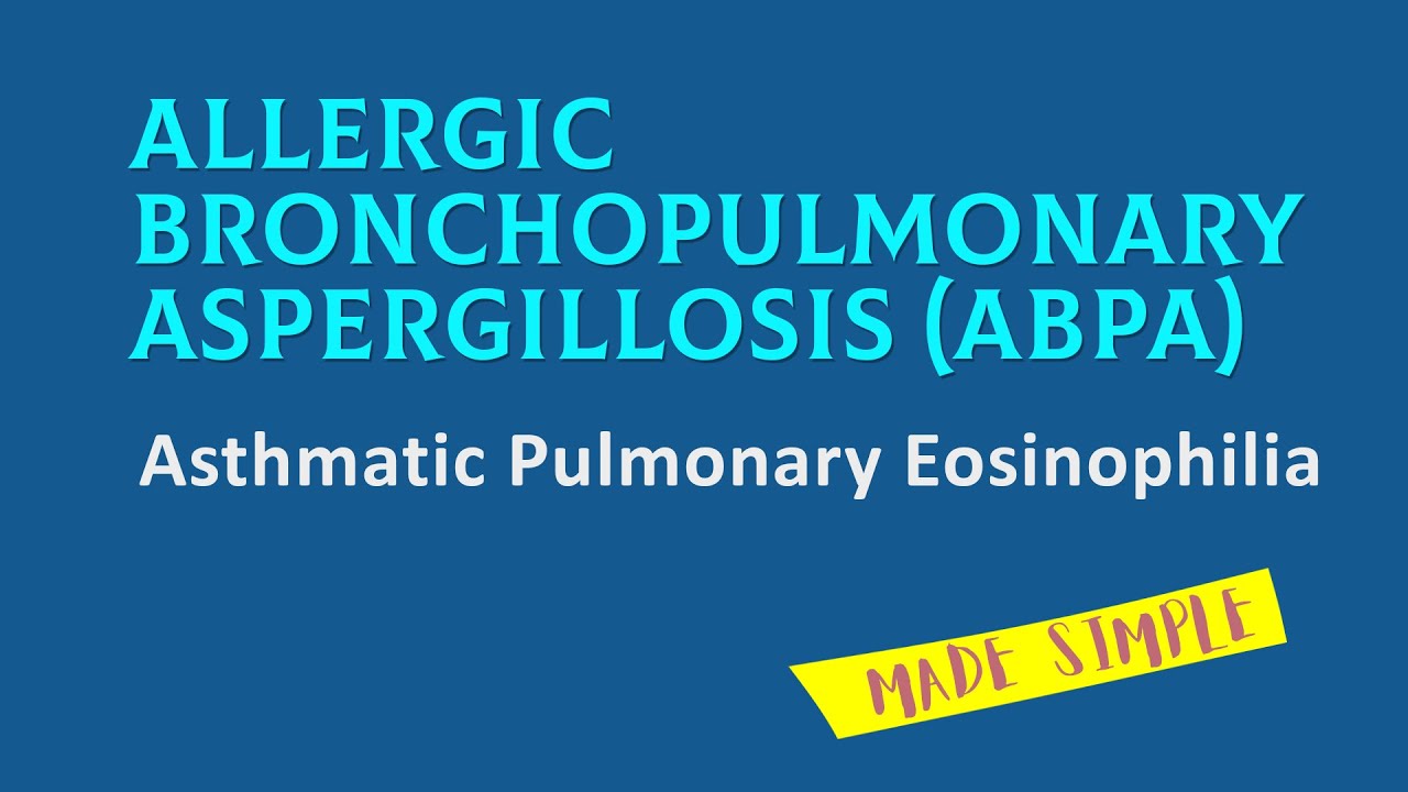 Allergic Broncho-Pulmonary Aspergillosis (ABPA) | Definition, Diagnosis ...
