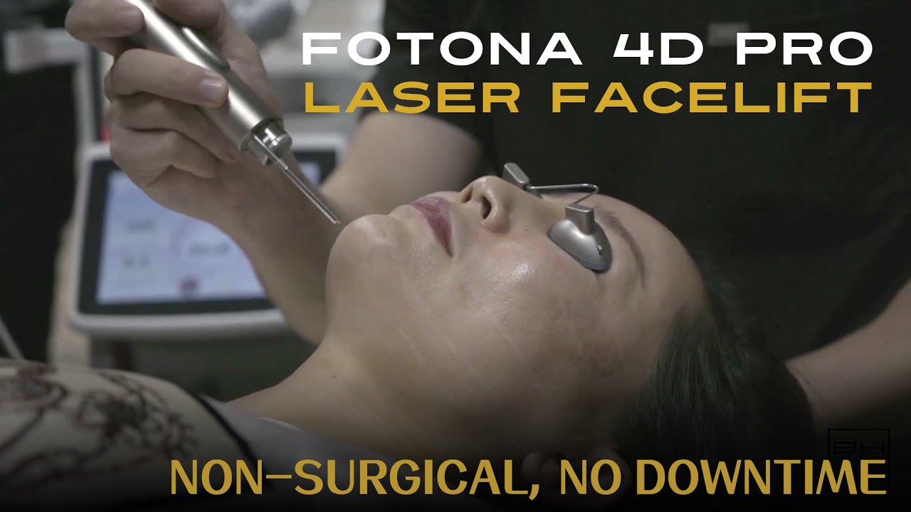 Fontona 4D Pro Laser Facelift 【BHPS】 - YouTube