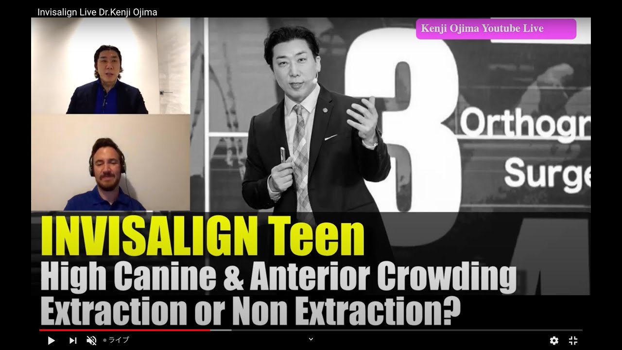 #7 Invisalign Youtube Live in English [Dr. Kenji Ojima] - YouTube