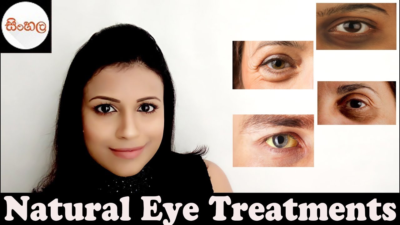 Natural Eye Treatments/Sinhala /Srilankan - YouTube