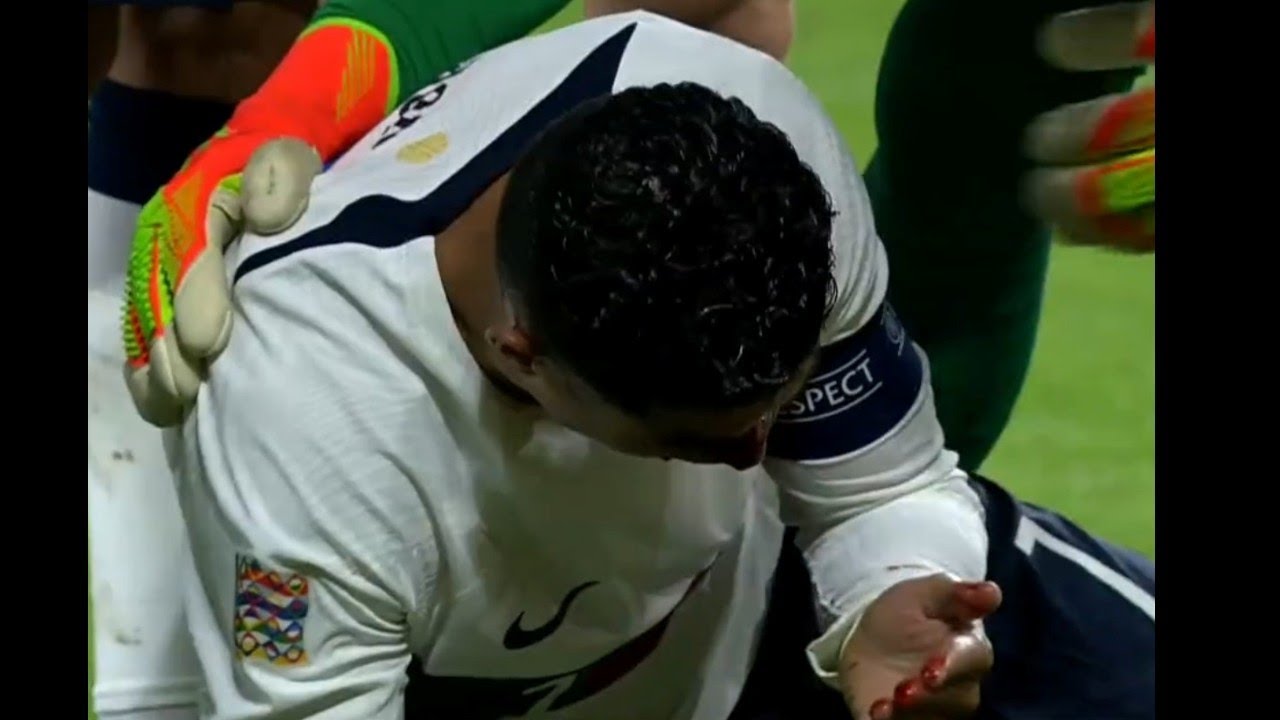 Cristiano Ronaldo injured by the Czech goalkeeper 😨 / Nations League ...