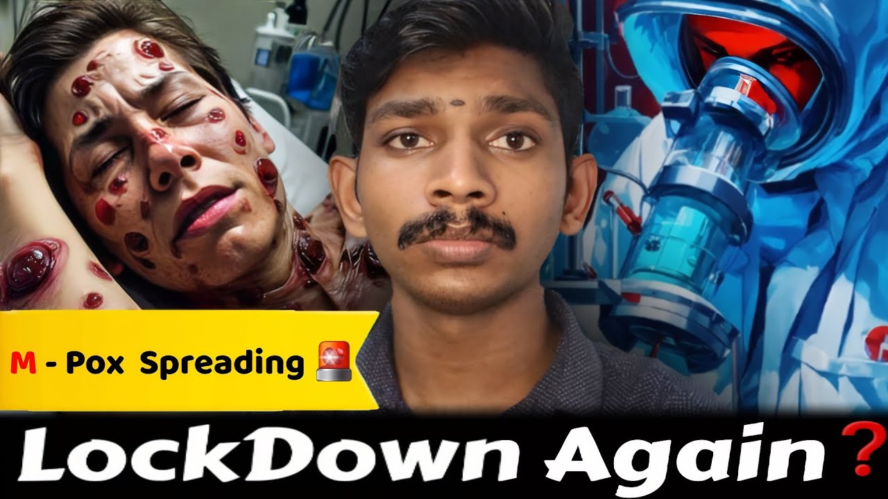 Monkey Pox 🚨 Spreading ⚠️ | Monkey Pox Explained Malayalam | Parthan ...