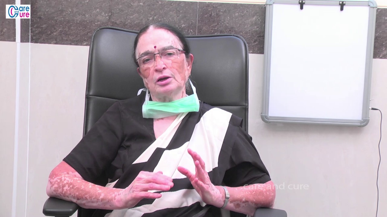 How To Cure PCOS With PCOS Natural Treatment | Causes & Remedies for ...