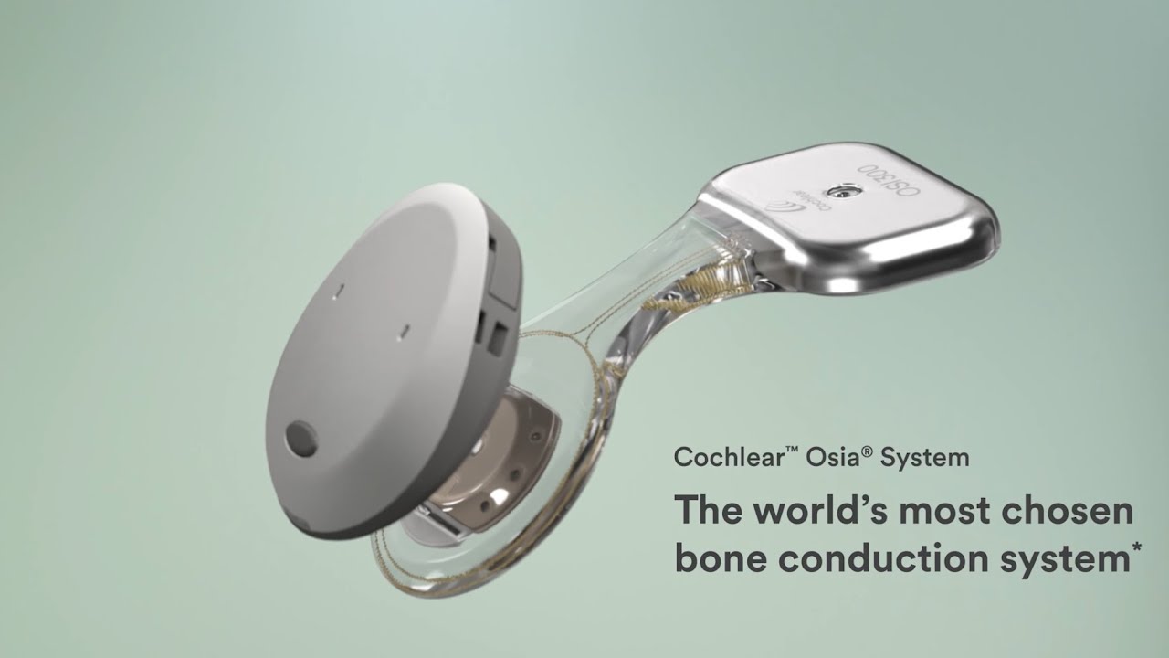 Sistemul Cochlear™ Osia ®- cea mai implantată soluție cu conducere ...