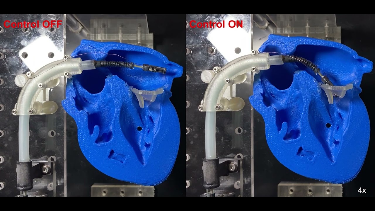 Video 3 - Demonstration in a phantom heart through a tortuous path ...