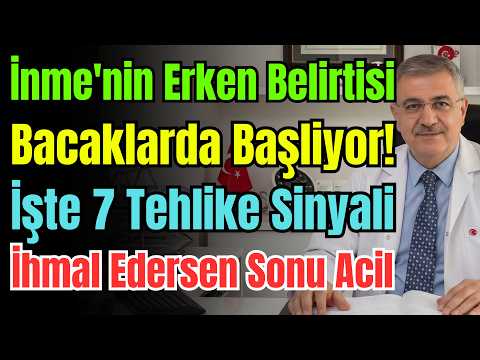 70'li Yaşlar Dikkat! Bacaklarınızın Gönderdiği 7 İnme Uyarısı Ve Alman Doktor'dan Önlemler